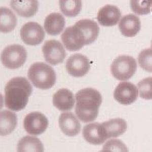 Poiquilocitos prueba - Ocas - Juego educativo - Salud - Mobbyt